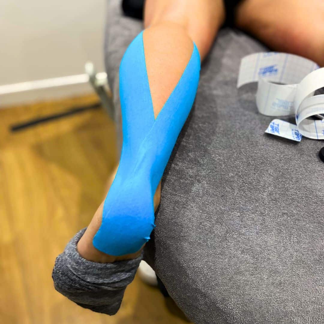 K-Taping | Cryojuvenate UK | Cryotherapy in Sevenoaks